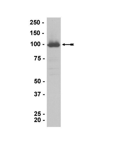 Anti-RAD21 Antibody | 05-908